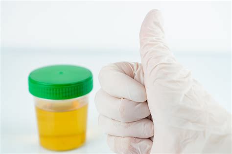 Urinalysis Its Definition Purposes Types And Results