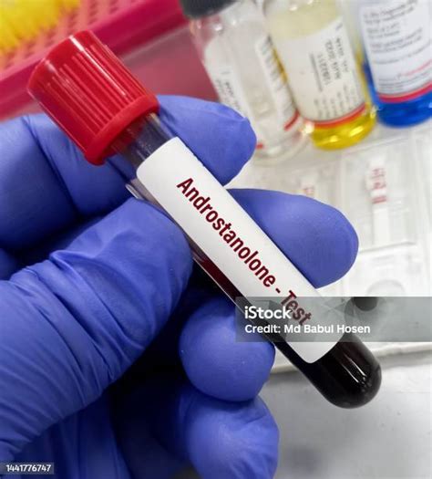 안드로스타놀론 또는 디하이드로테스토스테론 호르몬 검사를 위한 혈액 샘플이 있는 시험관 개념에 대한 스톡 사진 및 기타 이미지 Istock