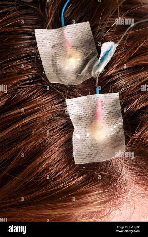 Electroencephalography EEG Electrodes On Girls Scalp EEG Measures And Records The Electrical