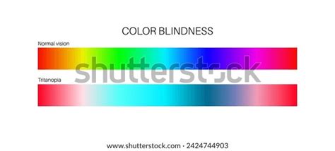 Tritanopia Vision Color Blindness Infographic Human Stock Vector Royalty Free 2424744903 Tritanopia Vision Color Blindness Infographic Human Stock Vector Royalty Free 2424744903