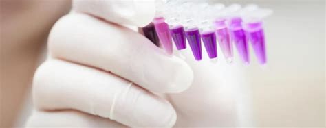 How To Choose An Isotype Control Antibody Creative Diagnostics