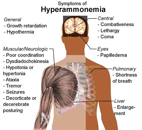 What Are Symptoms Of High Ammonia Levels At Lucy Dean Blog