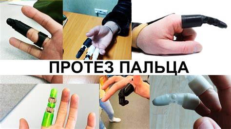 Протез пальца. Презентация. - YouTube