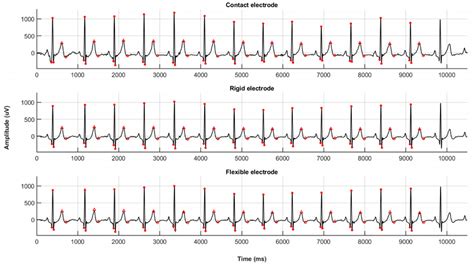 Ecg Spectra Obtained Simultaneously For These Three Acquisition Download Scientific Diagram