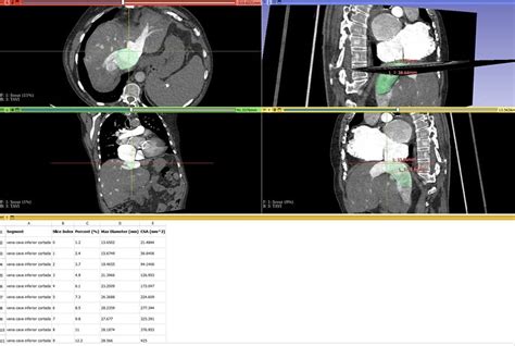 Segmentgeometry Support 3d Slicer Community