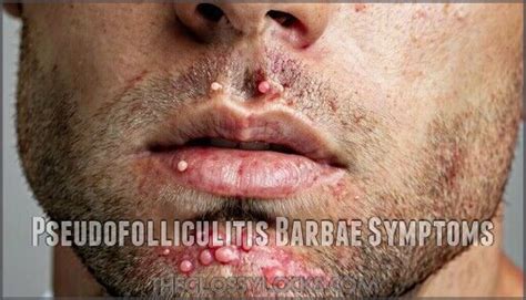Shaving Bumps Treatment 7 Fast Ways To Clear Razor Burn Today