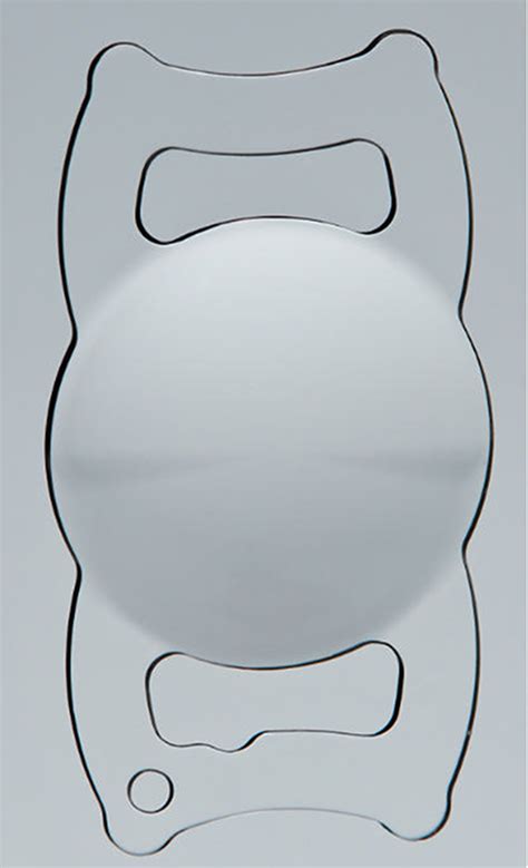 Outcomes Of A Refractive Segmented Bifocal Intraocular Lens With A Low