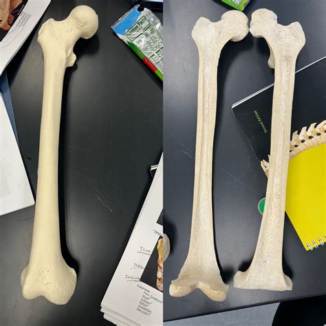 Femur Bone Structures Diagram Quizlet