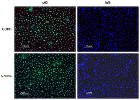 Figure E1 Immunofluorescence Against The Basal Cell Marker P63 Tp63 Download Scientific