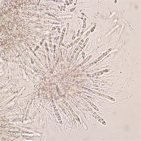 Lichens Of North Carolina