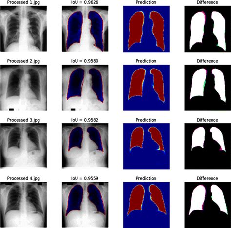 segmentation of lung from public database based on u net download scientific diagram