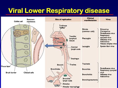 Ppt Lower Respiratory Tract Viral Infections`` Powerpoint