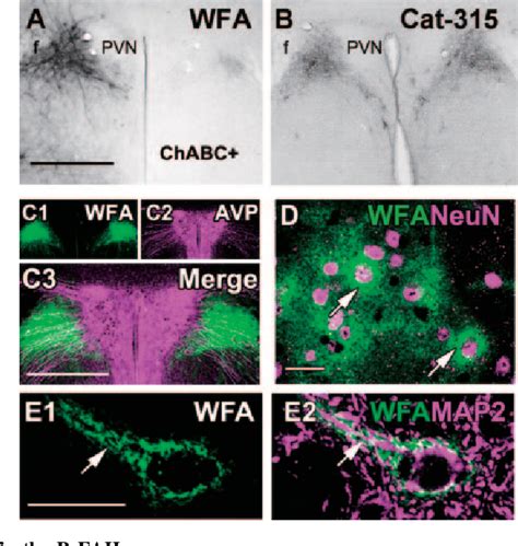 Figure 1 From A New Area Of The Mouse Anterior Hypothalamus Involved In Septohypothalamic