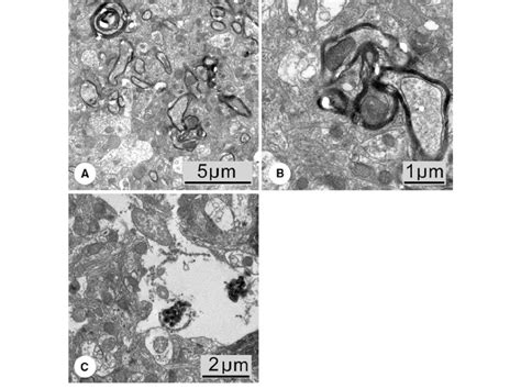 Electron Microscopy Of Brain Specimens From Car9 Mice The Samples