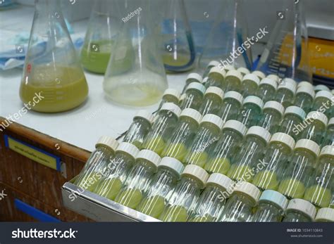 6件の「lowenstein Jensen Medium」の画像、写真素材、ベクター画像 Shutterstock