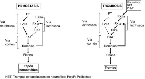Factor Xi Inhibitors A New Era In Antithrombotic Therapy Medicina Clínica English Edition
