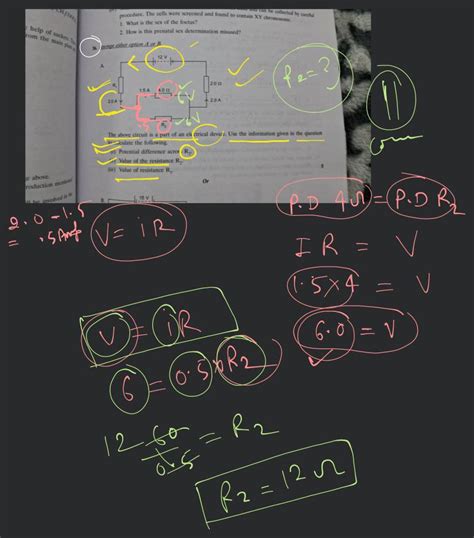 What Is The Sex Of The Foetus How Is This Prenatal Sex Determination Mis
