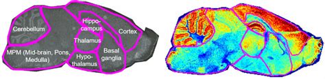 Mouse Brain Compartmentalization Used In This Study The Sagittal Plane