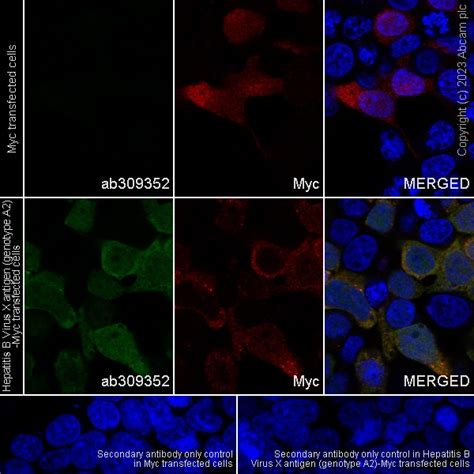 蛋白x重组抗体 Epr27041 49 Protein X抗体ab309352 Abcam中文官网 蛋白x重组抗体 Epr27041 49 Protein X抗体ab309352 Abcam中文官网