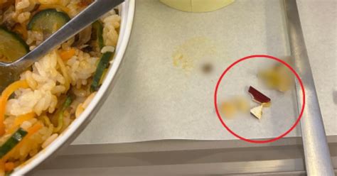 아시아나 기내식 먹다 우두두둑치아 3개 손상