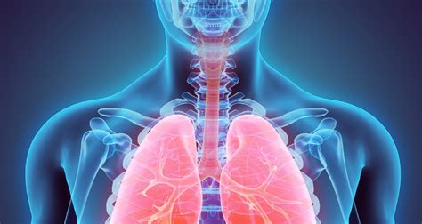 Eduard J On Linkedin A Case Of Worsening Dyspnea A Chronic Obstructive Pulmonary Disease