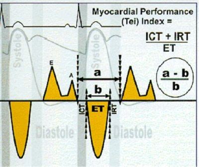Myocardial Performance Index MPI Cardiac Sonography Cardiac Nursing Cardiology