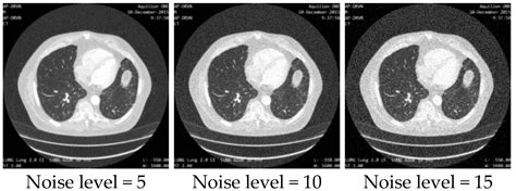 What Is Noise In Ct Scan At Susie Branch Blog