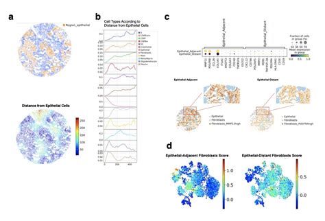 New Research Article On Spatial Transcriptomics For Lung Cancer