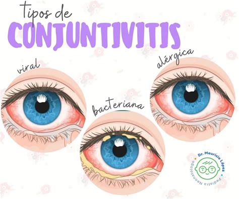 👁️ La Dr Mauricio López Pediatra Neonatólogo
