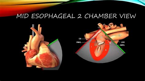 Tee Views Transesophageal Echocardiography Viewspptx