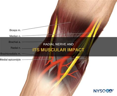 Radial Nerve And Its Muscular Impact Cyvigor