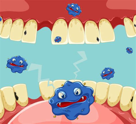 Decoding Vertical Vs Horizontal Bone Loss In Oral Health