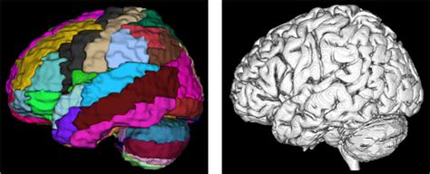 Surface Rendering Of The Brain Template Used In Our Voxel Based