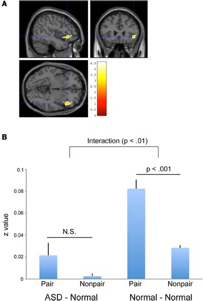 Inter Individual Correlation Using Residual Data A Significant