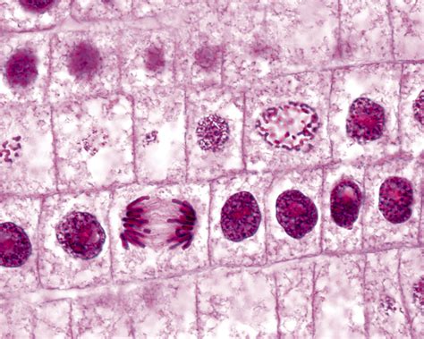 Stages Of Mitosis Under The Microscope Mitosis