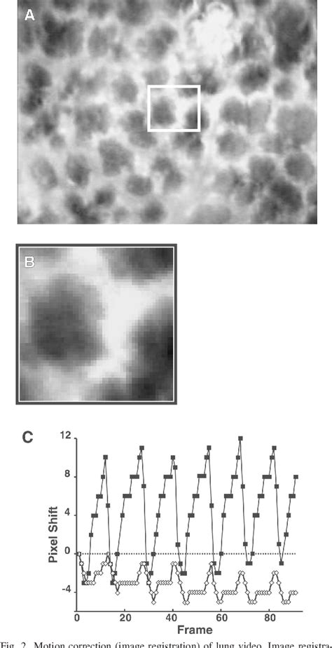 Figure 1 From Mapping Of The Functional Microcirculation In Vital
