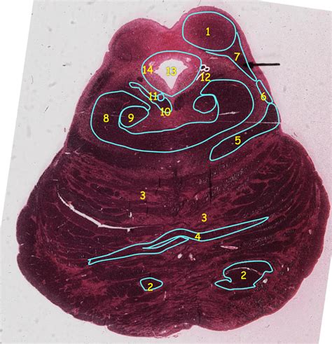 Caudal Midbrain Diagram Quizlet