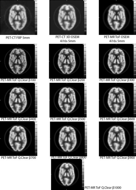 Performance Evaluation Of The Qclear Reconstruction Framework Versus Conventional