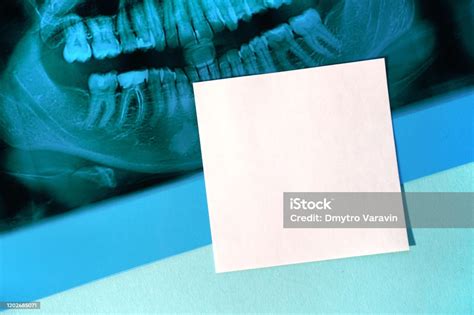텍스트에 대한 빈 백서와 파노라마 치과 치아 엑스레이 필름 위의 보기 공간을 복사합니다 X 레이에 대한 스톡 사진 및 기타 이미지 Istock