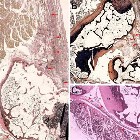 A B Verification Of Elastic Fiber Staining Arrows Of Verhoeff Van Download Scientific