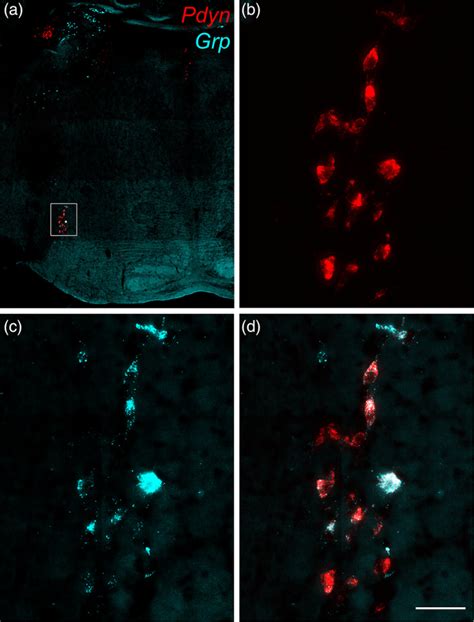 Input Output Connections Of Lja5 Prodynorphin Neurons Abstract