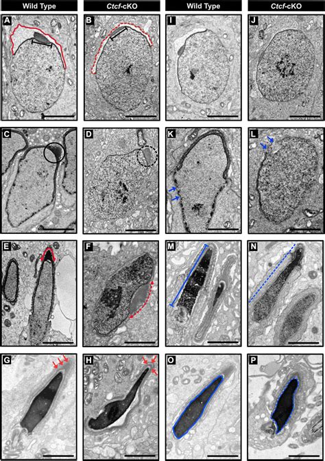 frontiers spermiogenesis alterations in the absence of ctcf revealed