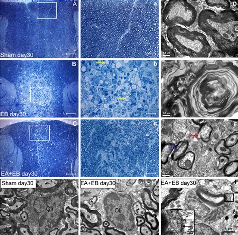 Myelin Counting And Electron Microscopy Ac Toluidine Blue Stained