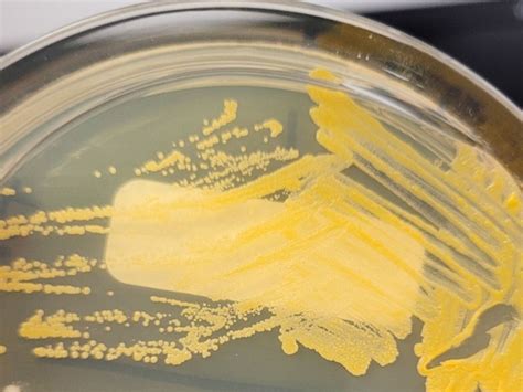 Deinococcus Radiodurans Gram Stain