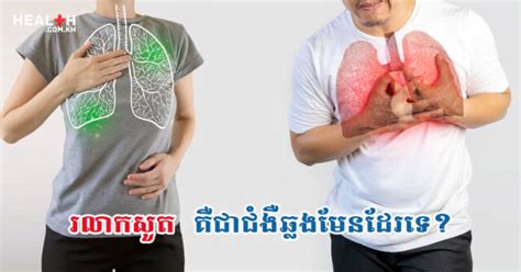 រលាក សួត គឺជា ជំងឺឆ្លង មែនដែរ ទេ