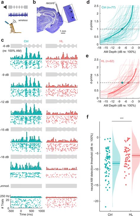 Single Unit Analysis Reveals Poorer Neural Detection Thresholds In The Download Scientific