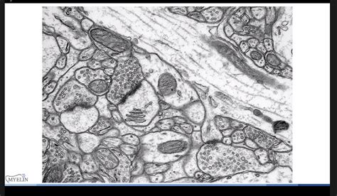 My Misconception Of Neurobiology 2 By Deulkardr Medium