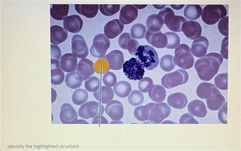 Solved Identify The Highlighted Structure Identify The