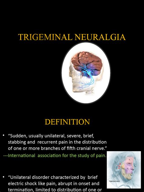 Trigeminal Neuralgia Pdf Clinical Medicine Nervous System