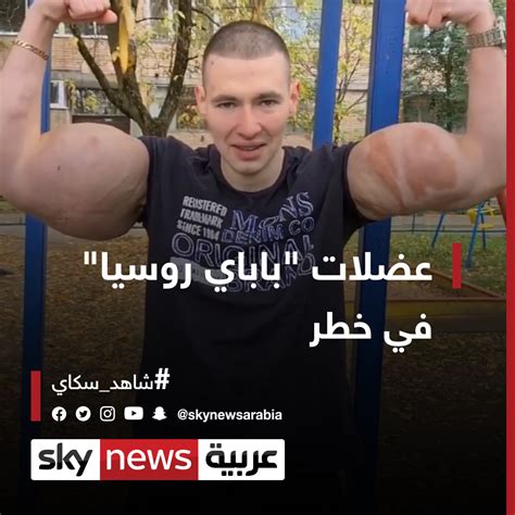 عضلات باباي في خطر عضلات باباي في خطر شاهدسكاي By ‎sky News